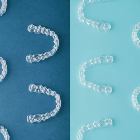 Apparecchio trasparente: cos’è e come funziona - DentalPro